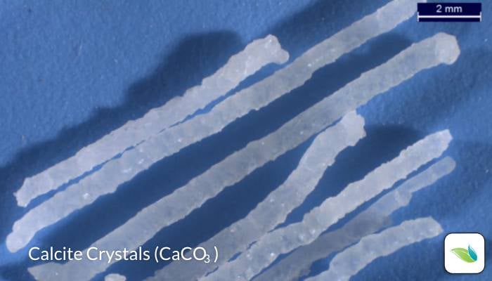 Calcium Crystals vs. Scale